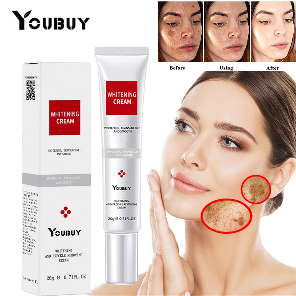 YouBuy Freckle Removal Cream Whitening Anti Melasma Removal and Dark ...