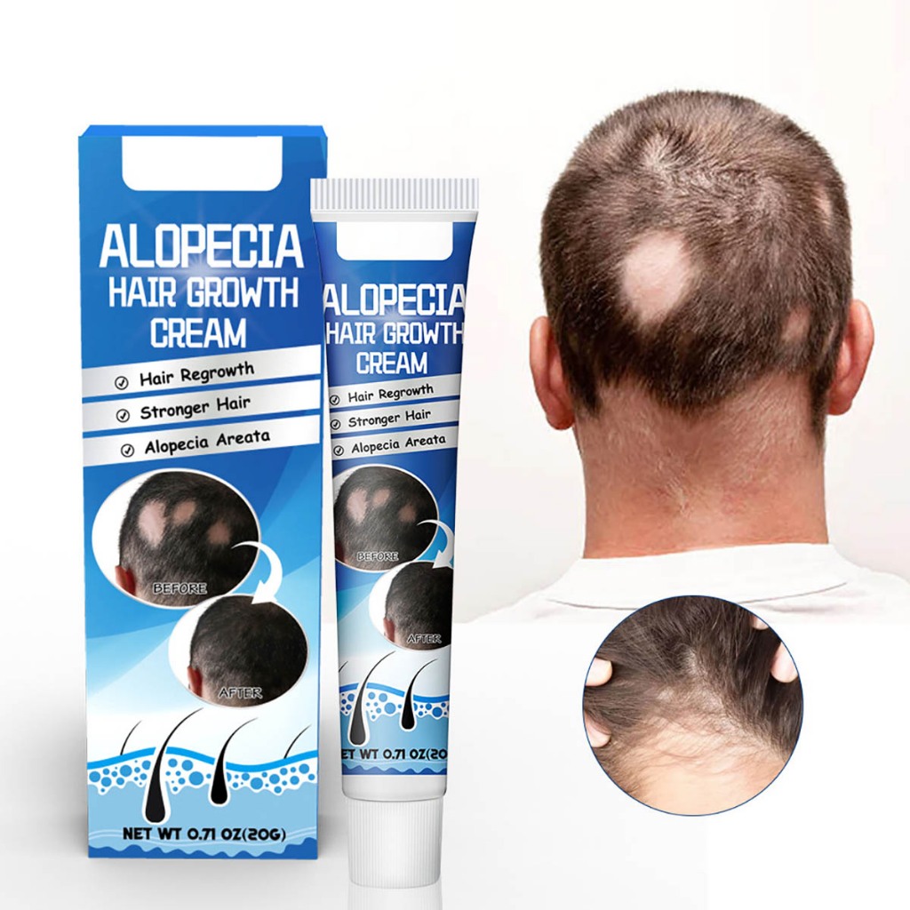 20g Alopecia Hair Growth Cream Anti Hair Loss Fast Growing ป้องกันแห้ง ...