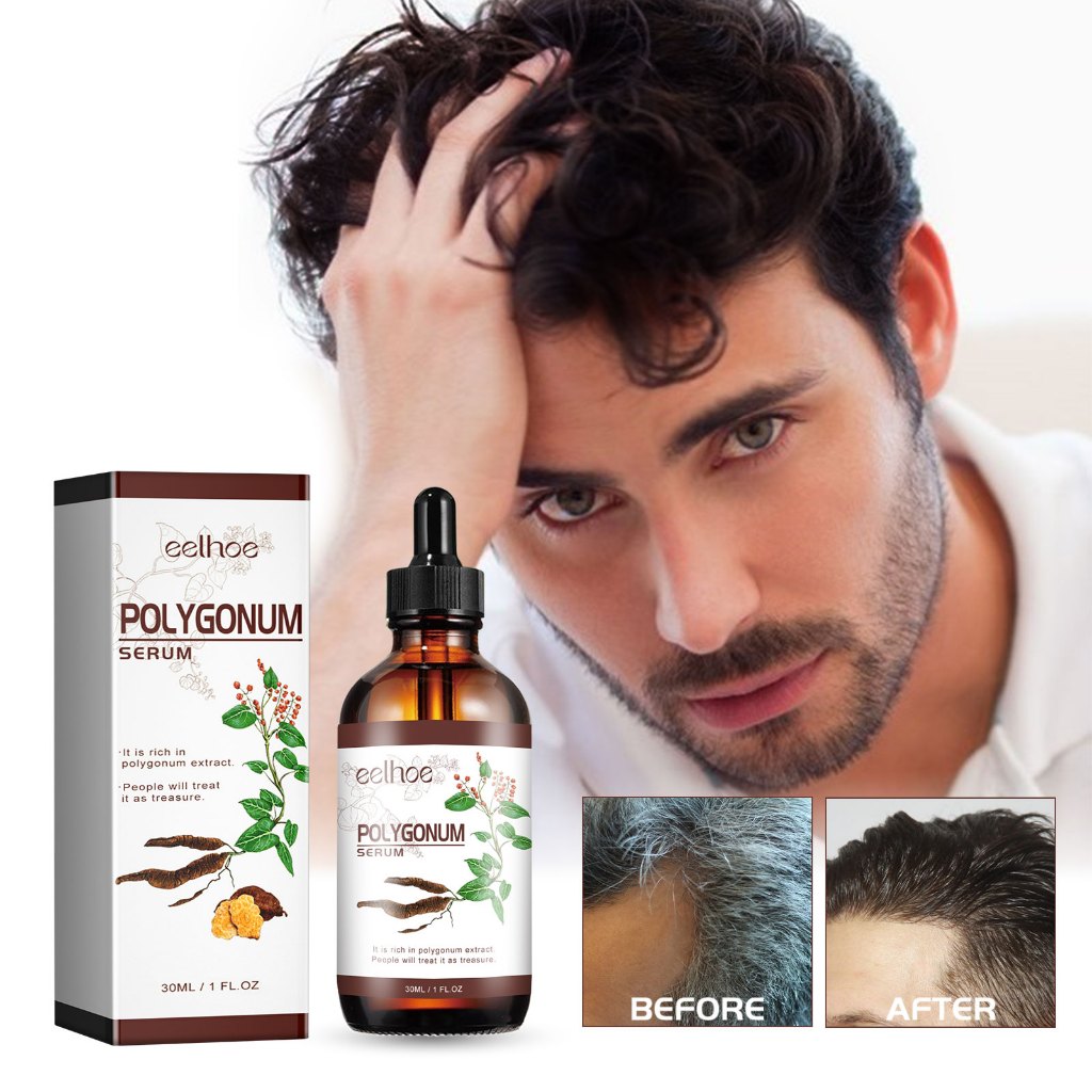 Eelhoe Hair Care Serum Polygonum Essential Oil Anti Hair Loss สีขาวครอบคลุมหนังศีรษะ Treatment ...