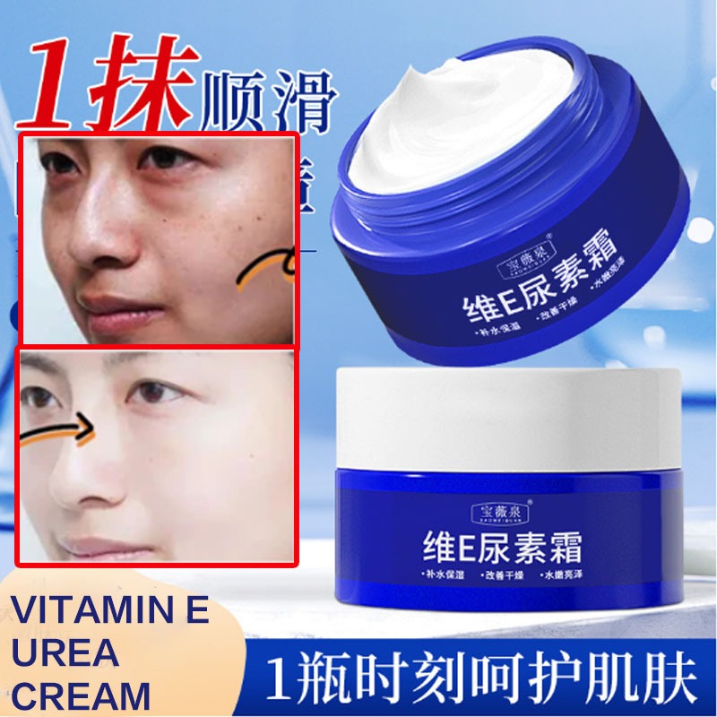 [COD] Yellow Spots Disappear Spot Fading Vitamin E Urea Cream Hydrating ...