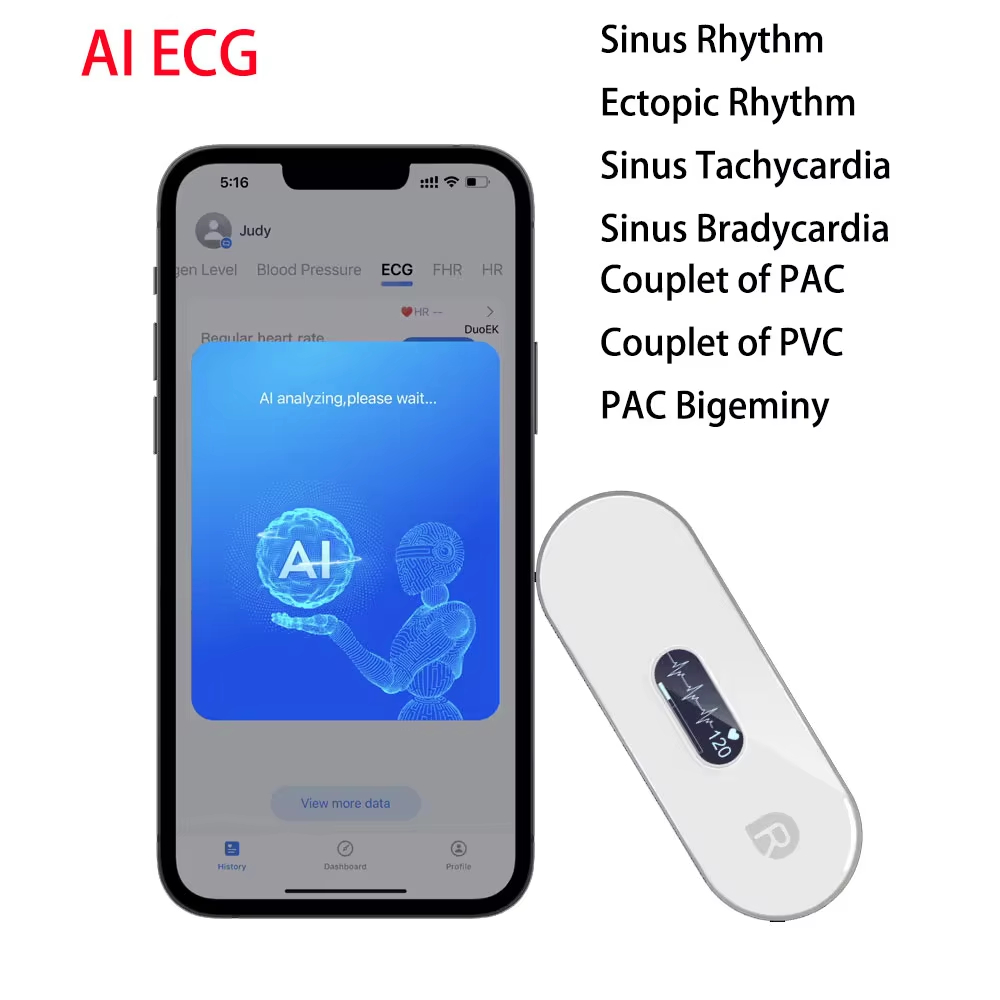 บลูทูธ ECG Monitor พร้อม OLED EKG AI AnalysiArrhythmias Holter Heart ...