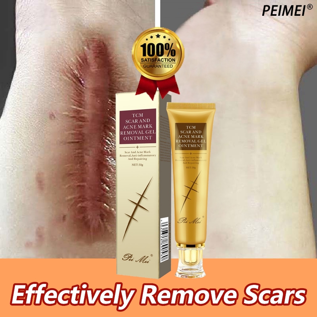 PEIMEI ครีมลดรอยแผลเป็น 30g ซ่อมแซมรอยแผลเป็นเก่าและใหม่ ปรับปรุงการ ...