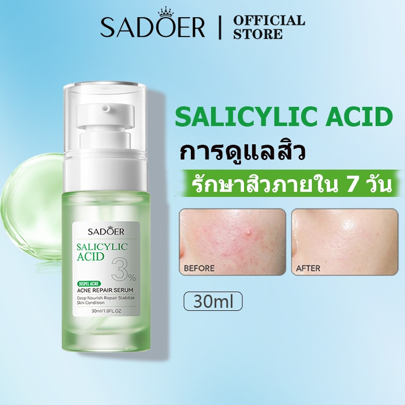 SADOER 3% Salicylic Acid Acne Serum 30ml ป้องกันสิว ลดการอักเสบ สำหรับการรักษาและป้องกันสิว เซ ...