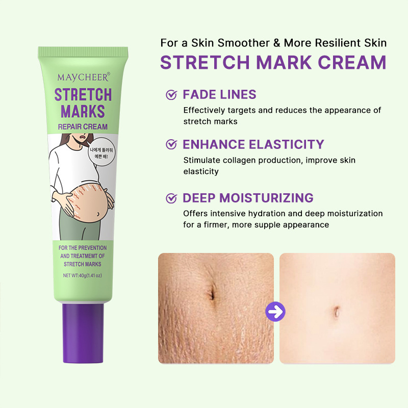 Stretch Mark Remover Cream Anti Stretch Mark Maternity Skin Repair ลบ ...