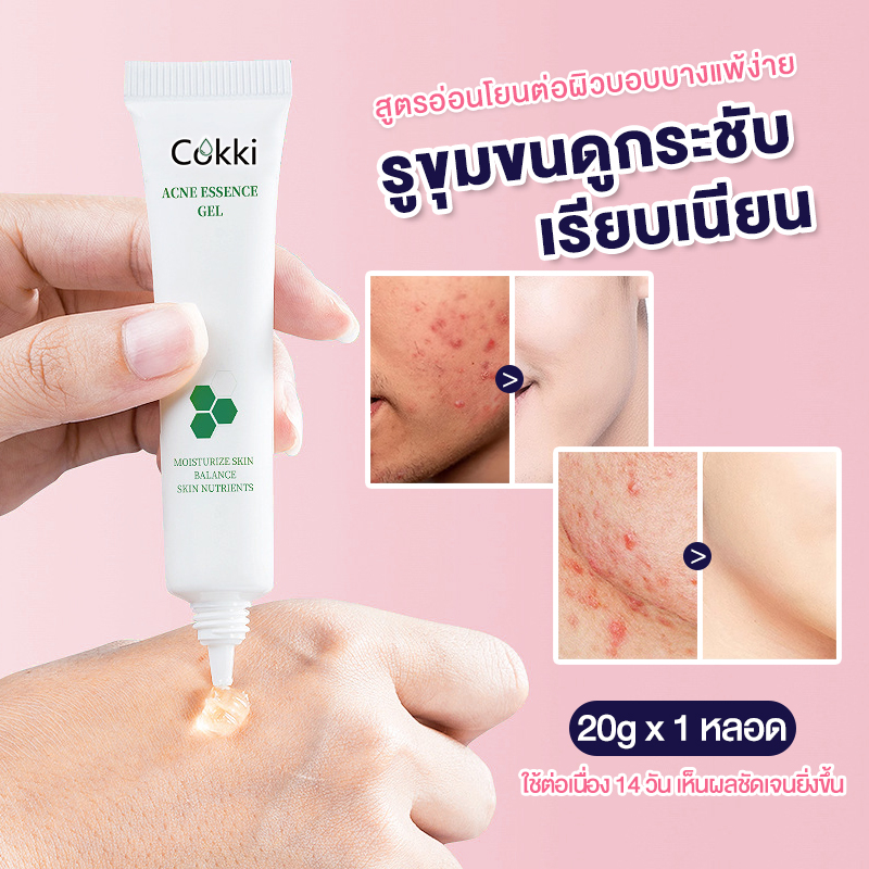 Cokki เจลใบบัวบก 20g เจลแต้มสิว (หลอด) ลดสิวผด ลดโอกาสเกิดสิวอุดตัน ลดการอักเสบของผิว Centella ...