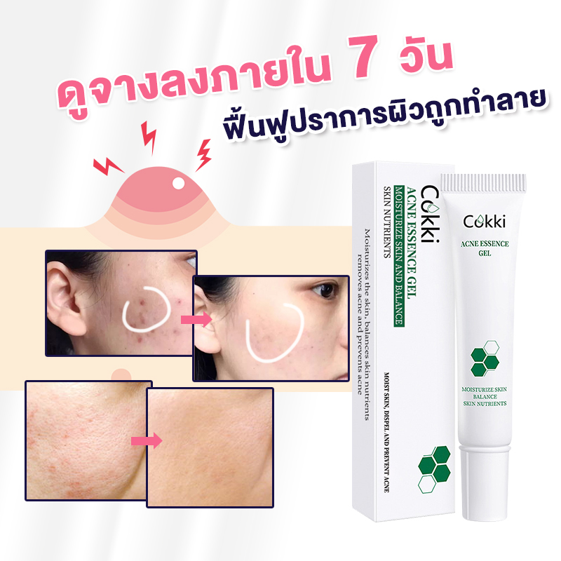 Cokki เจลใบบัวบก 20g เจลแต้มสิว (หลอด) ลดสิวผด ลดโอกาสเกิดสิวอุดตัน ลดการอักเสบของผิว Centella ...