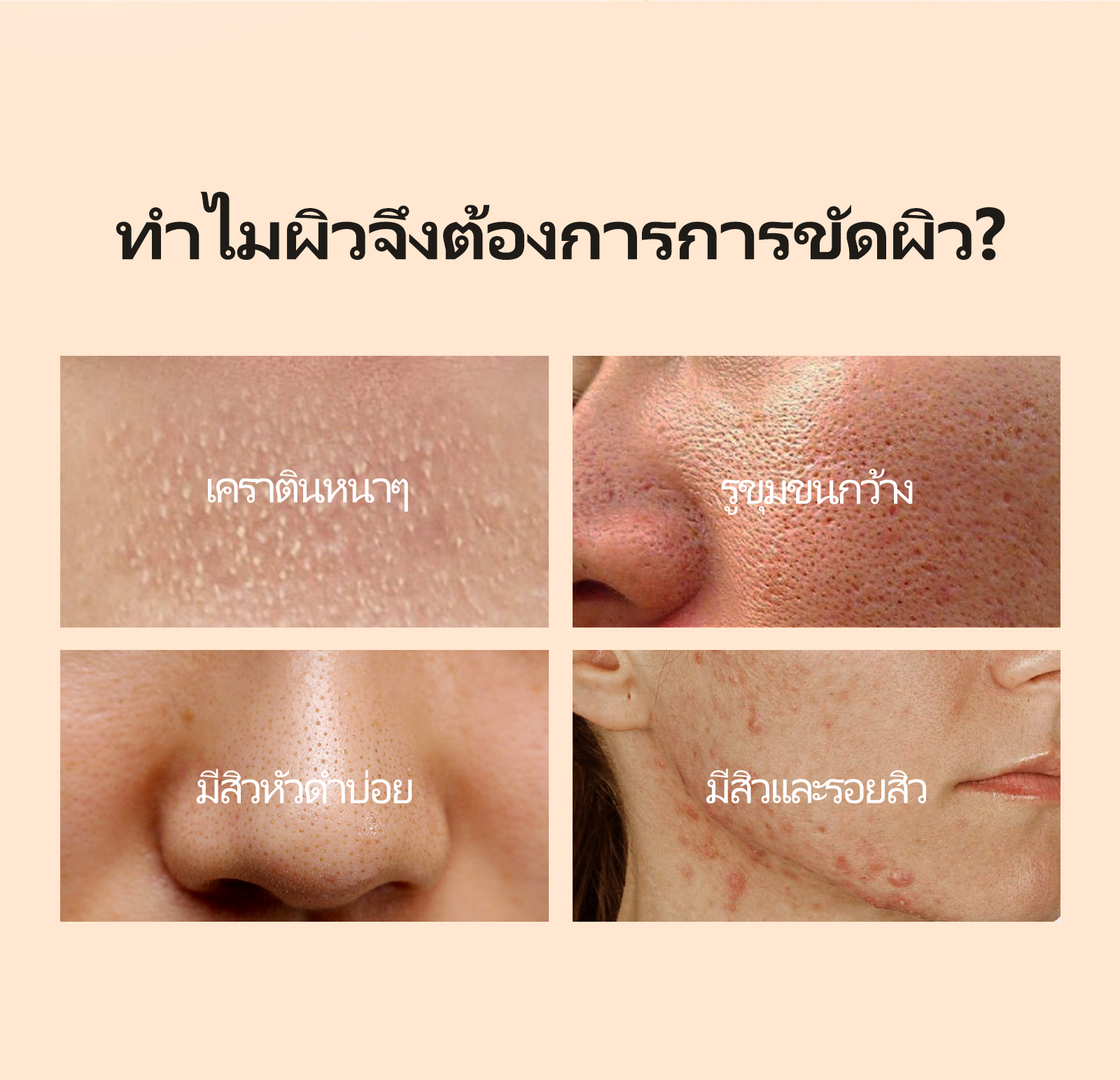Gmeelan ORANGE ENZYMES EXFOLIATING BRIGHTENING PEELING GEL เจลผลัดเซลล์ ...