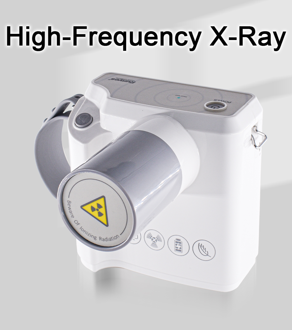 Runyes 70KV 2mA Dental X-Ray Unit ความถี่สูงดิจิตอลแบบพกพาหน้าจอสัมผัส ...