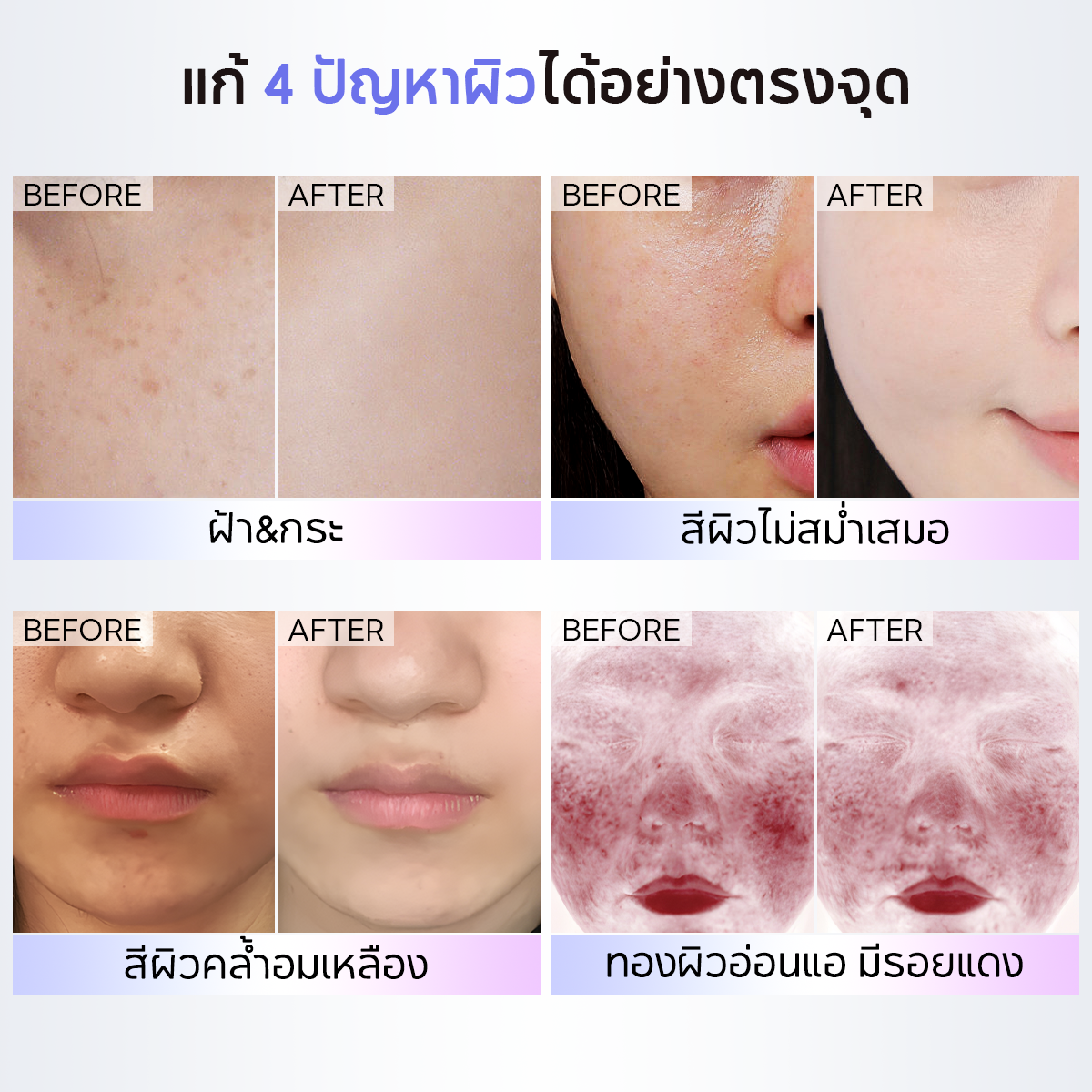 PAPA FEEL ลดจุดด่างดำ ผิวแข็งแรง 4 ชิ้น | ครีม เซรั่ม 577 + 5X Ceramide ...