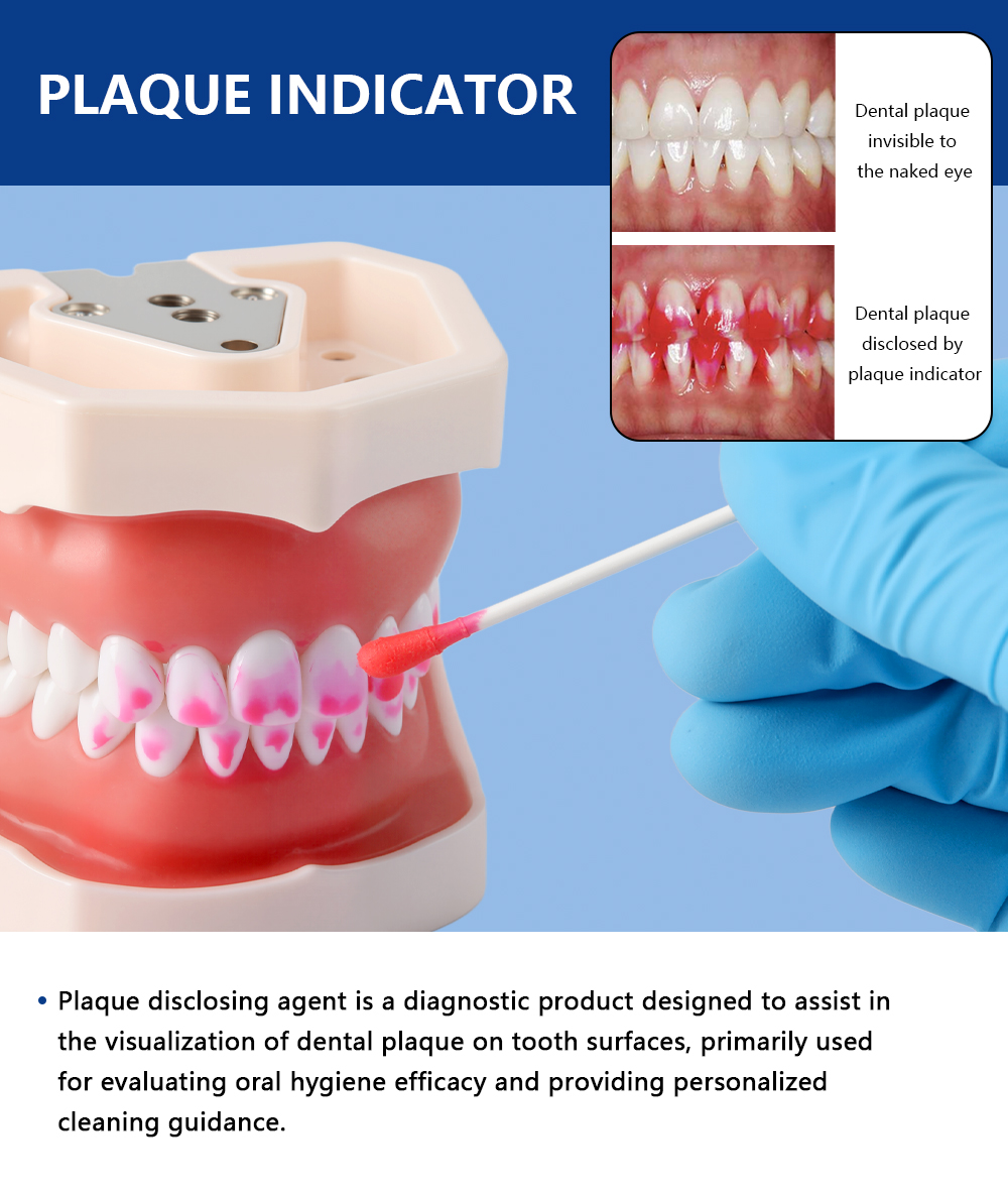 Plaque Discloss Agent Oral Tartar Test Examination Dental Plaque ...