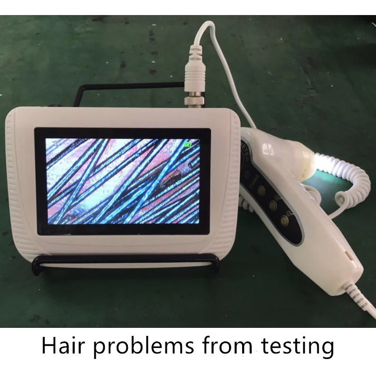 เครื่องแสกนผิว แสกนเส้นผม กำลังขยาย50-200x รุ่น SC-004 Facial Skin ...