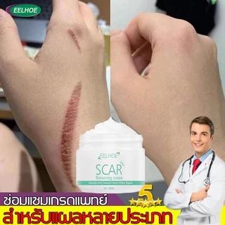 ReDelli Scar เจลทาแผลเป็น ยาลบรอยแผลเป็น ครีมลดรอยแผลเป็น 9 กรัม ราคา ...