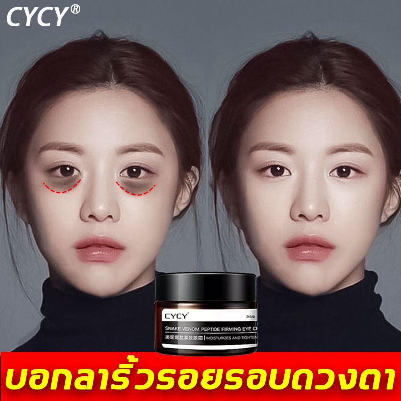 CYCY ครีมทารอบดวงตา30mlทำให้รอยคล้ำจางลง บรรเทาปัญหาต่างๆรอบดวงตา ครีม ...
