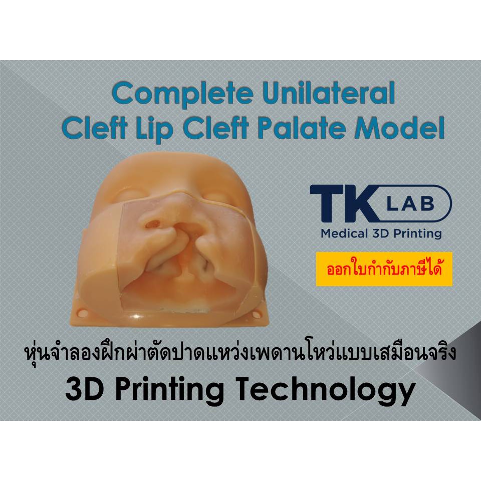 Cleft Lip Palate Model (left unilateral) หุ่นจำลองทางการแพทย์ ปากแหว่งเ ...