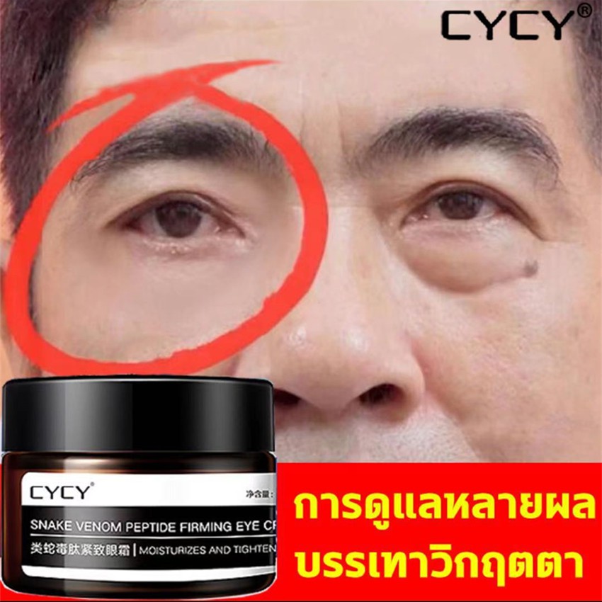 ครีมลบใต้ตาดำ ครีมทารอบดวงตา ครีมแก้ขอบตาดำ eye cream CYCY อายครีมบำรุง ...