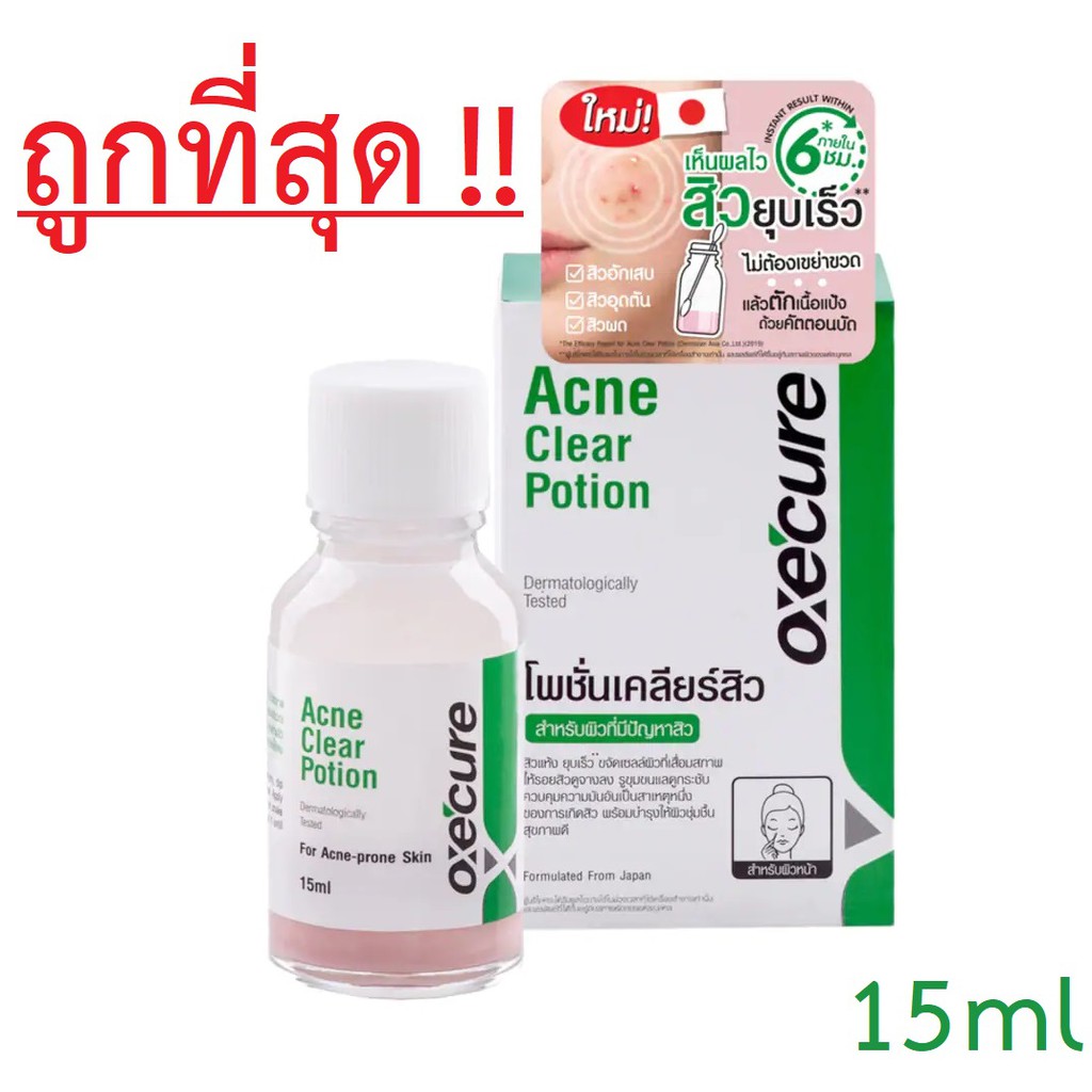 Oxecure Acne Clear Potion 1ขวด ขนาด15ml Oxe Cure อ๊อกซีเคียว แอคเน่ ...