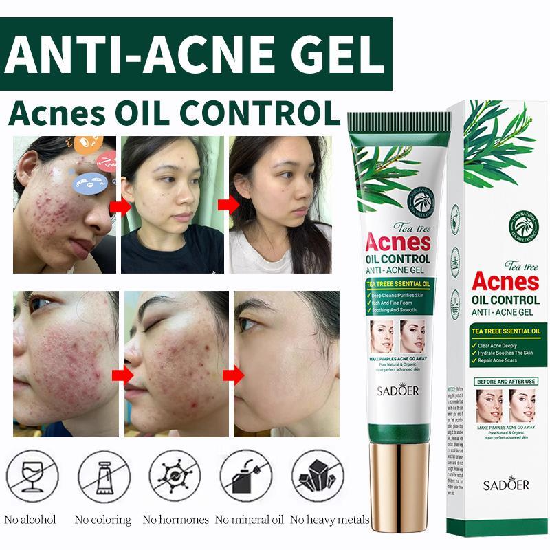 20g Tea Tree Acnes Oil Control Anti-Acne Gel Clear Spot และ Pimple ...
