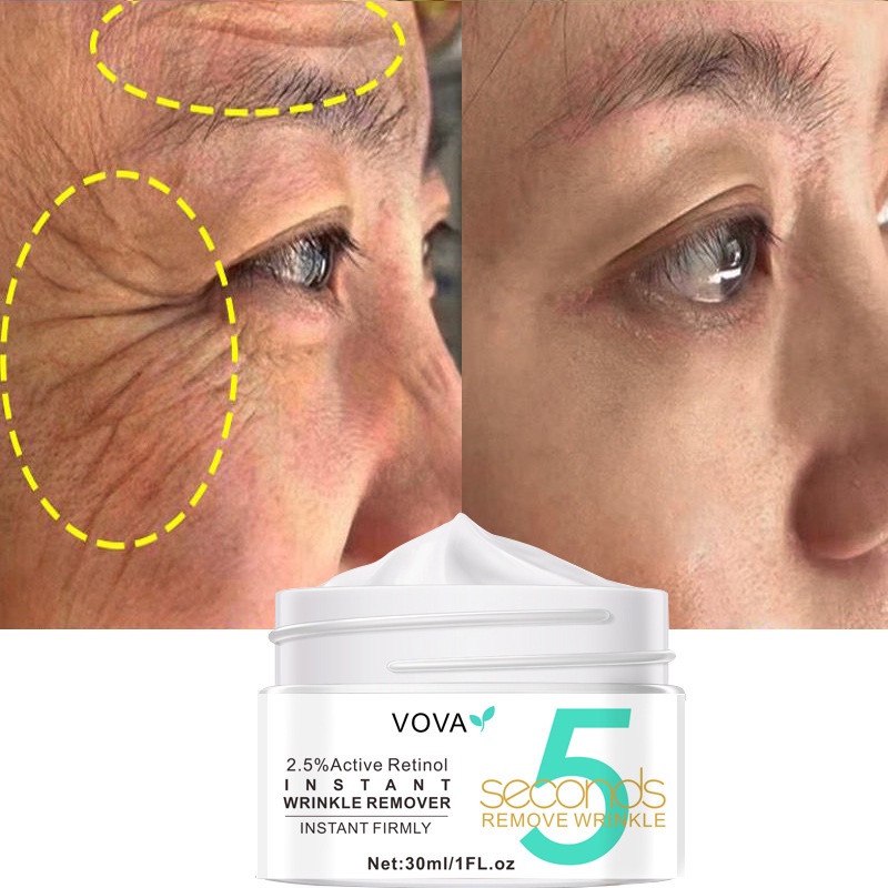 Vova 2.5 % Active Retinol Face Cream 30ml Anti-Wrinkle Face/Eye Essence ...