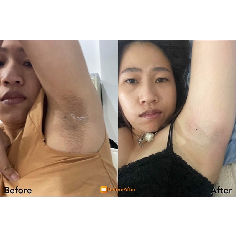 ครีมรักแร้ขาวเนตราNeta | Shopee Thailand