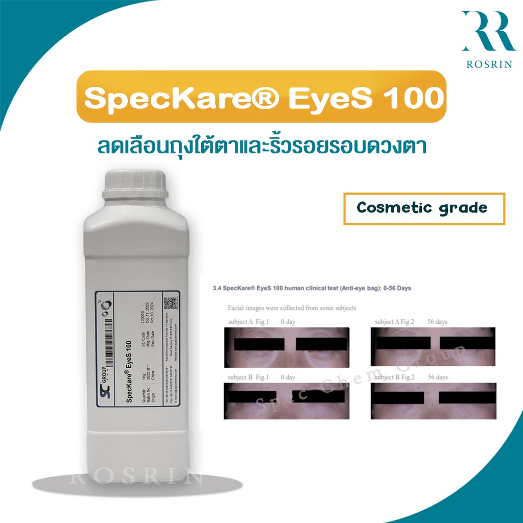 SpecKare® EyeS 100 ลดเลือนถุงใต้ตาและริ้วรอยรอบดวงตาอย่างมีประสิทธิภาพ ...