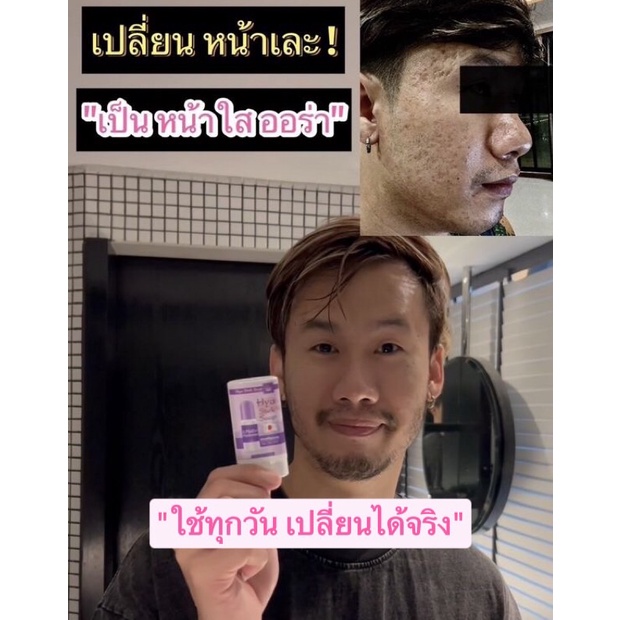 เปลี่ยนหน้าเละ ! ให้ใสออร่า Hya stick soap สบู่สูตรเข้มข้น แก้ปัญหาผิว ...