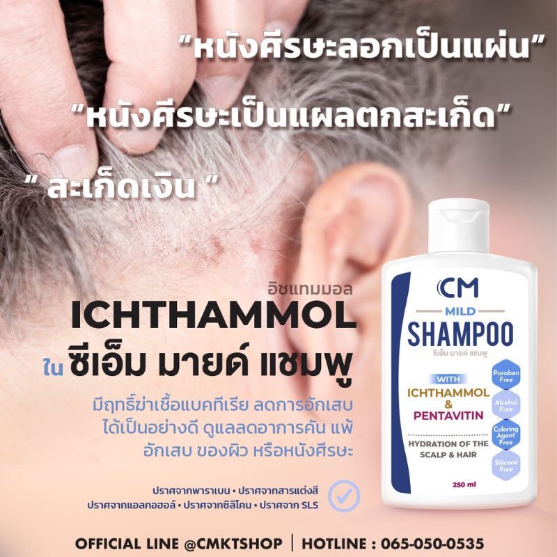 CM Mild Shampoo ซีเอ็ม มายด์ แชมพู แชมพูที่เหมาะกับทุกปัญหาของหนังศีรษะ ...