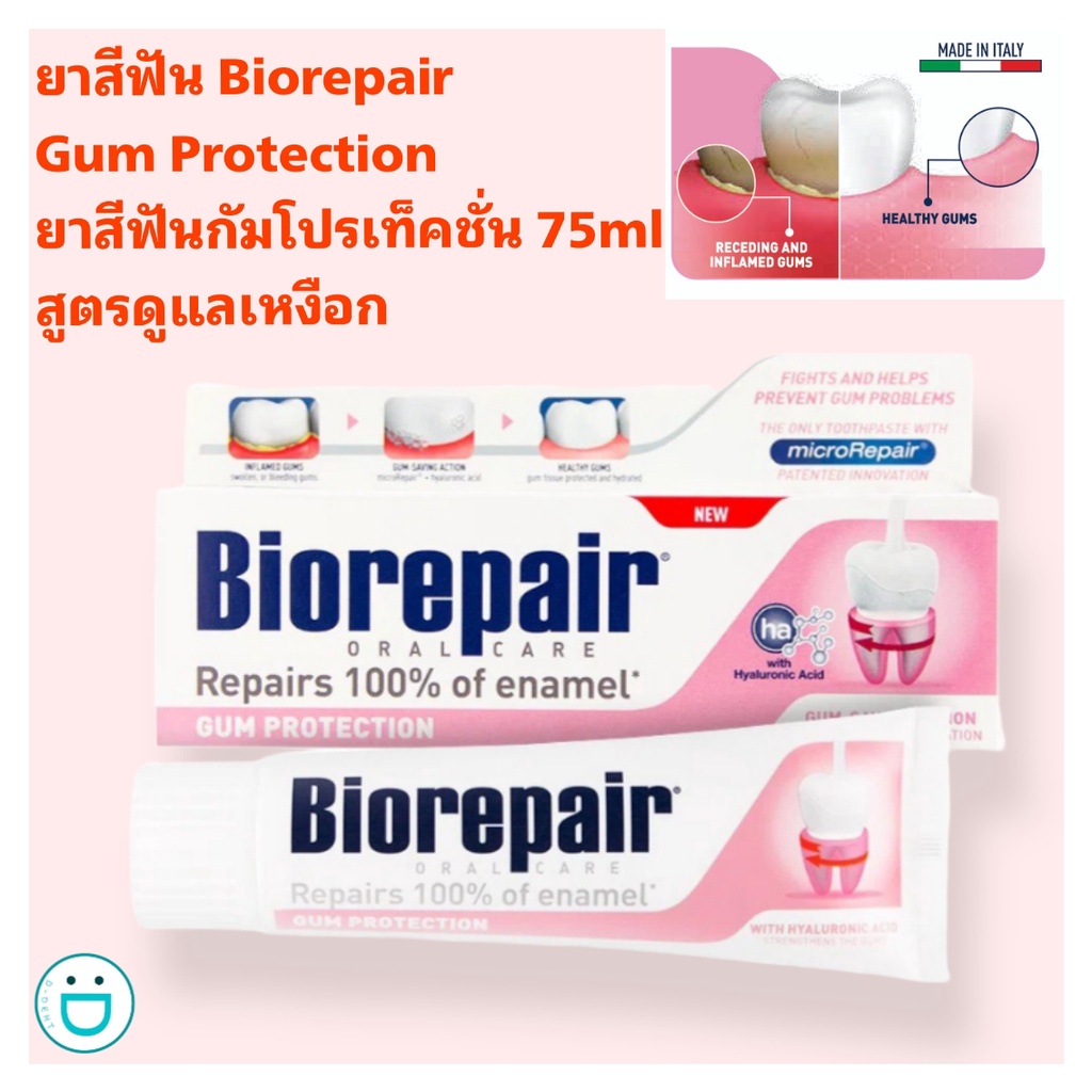 ยาสีฟัน ดูแลเหงือก โรคเหงือก Biorepair Gum protection 70 ml | Shopee ...
