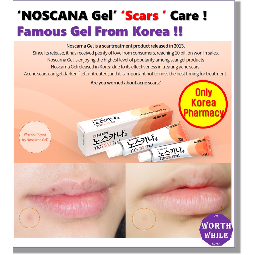 Noscarna gel 10g, ครีมจากเกาหลี /Scar Removal /Acne & Pimple After Care ...
