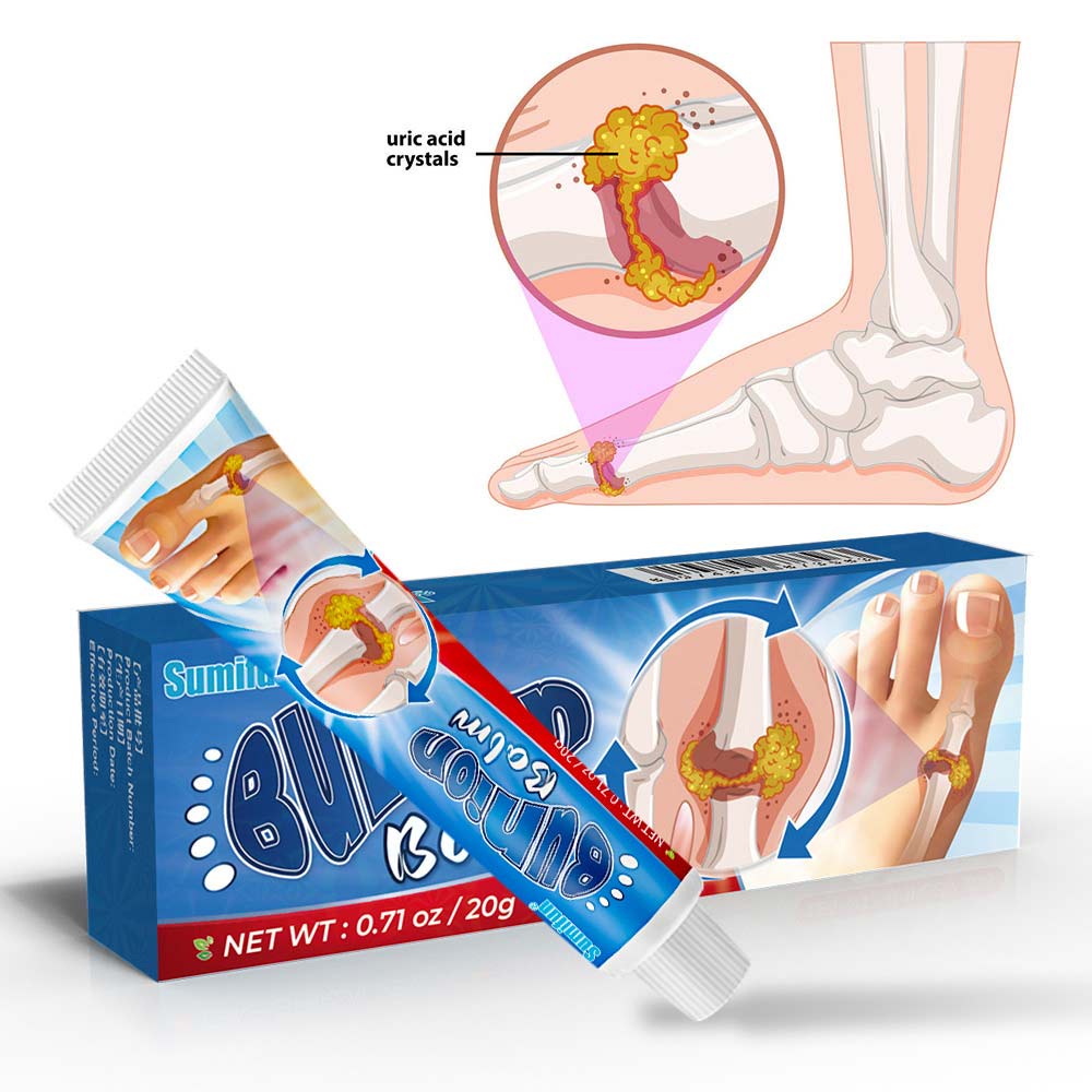 Pain Relief Cream Gout Ointment Natural Joint Toe Pain Relieving ...