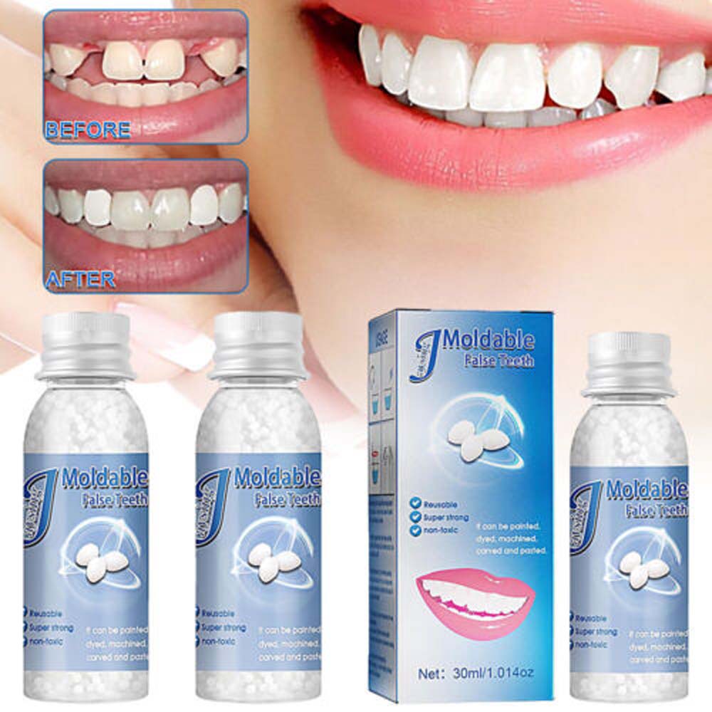 30ML Temporary Tooth Repair Kit Teeth and Gaps Moldable Falseteeth ...