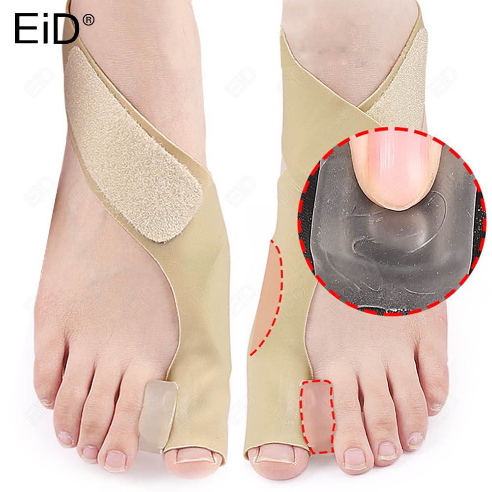 ตัวแยกนิ้วเท้า Hallux Valgus Bunion Corrector ปรับขนาดฟรีกายอุปกรณ์เท้า ...