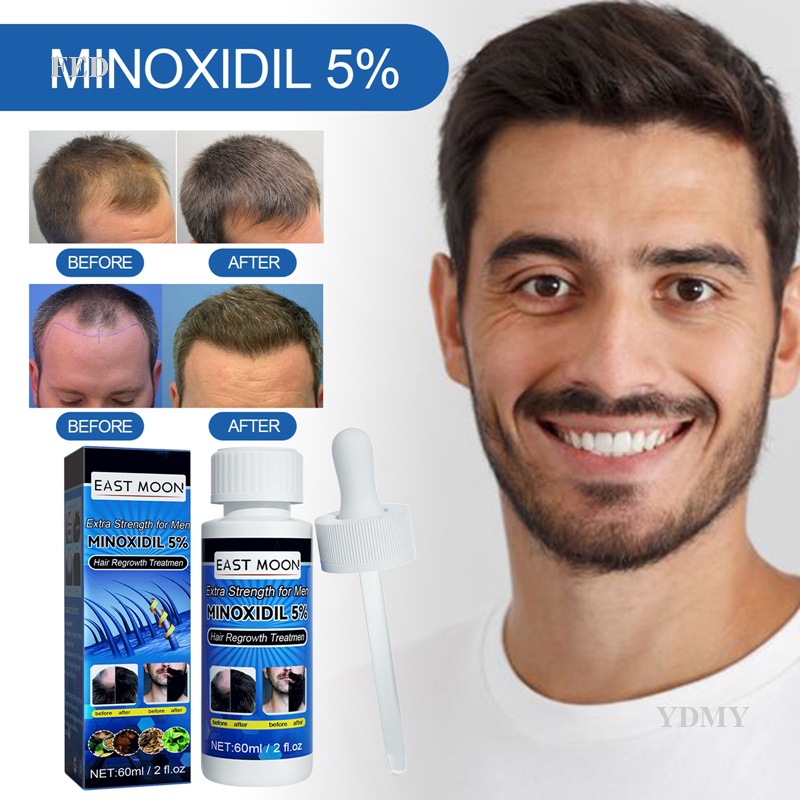 Fedealk Minoxidil น้ํามันปลูกผม 5% แข็งแรงพิเศษ ลดผมร่วง สําหรับผู้ชาย | Shopee Thailand