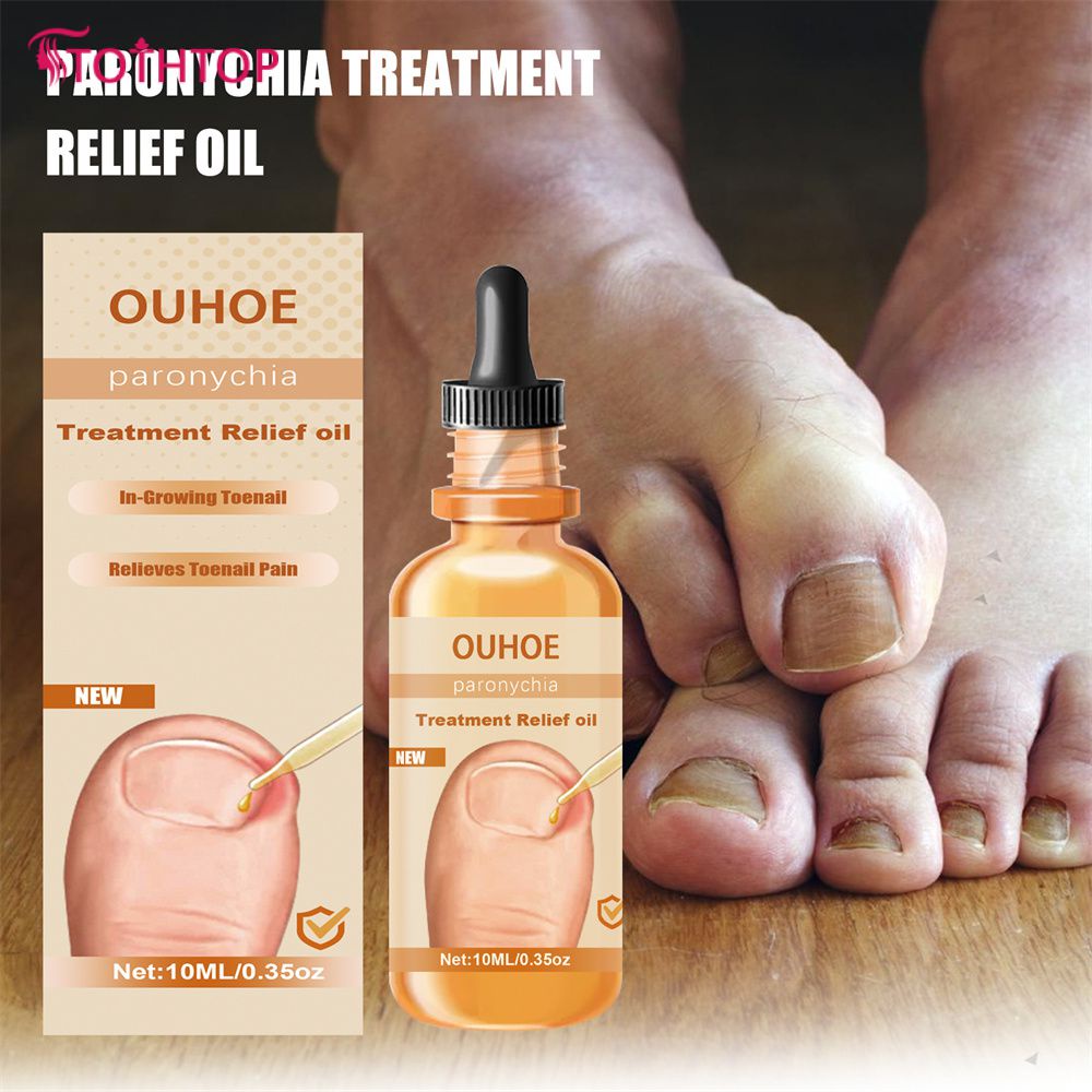 Ouhoe Paronychia Treatment Relief Oil Onychomycosis Repair Serum Repair ...