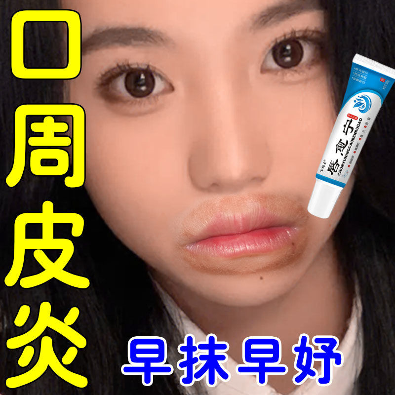 รักที่จะเลียริมฝีปากวงกลมสีแดงรอบปาก Perioral derma爱ปากปากปากPang Red ...