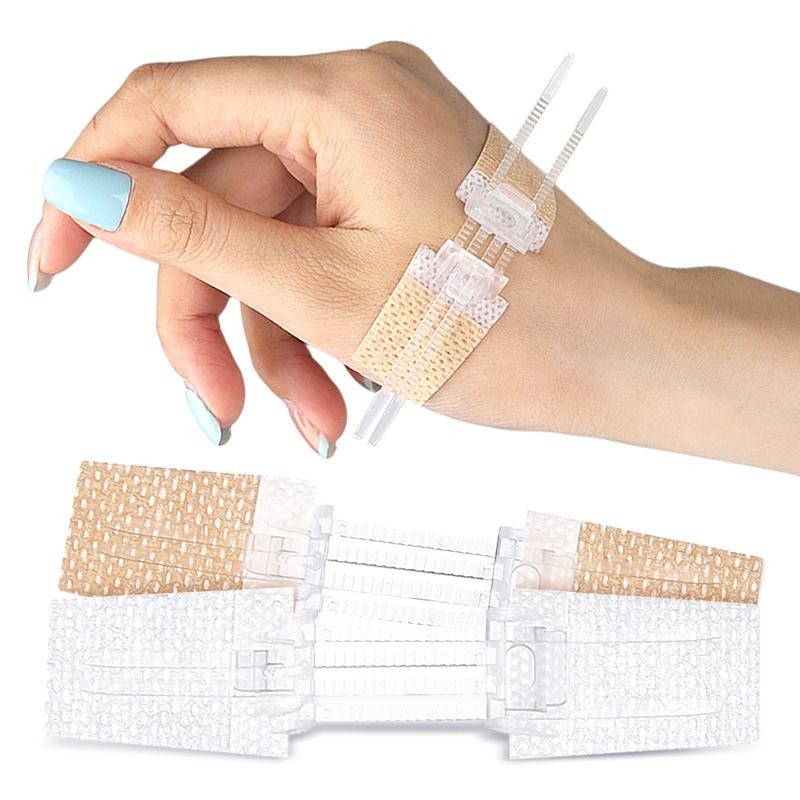 ซิป Tie Wound ปิด Patch Hemostatic Patch Wound Fast ไม่มีเย็บซิป ...