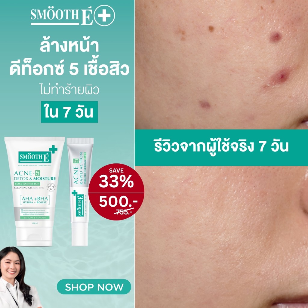 [แพ็คคู่สุดคุ้ม] Smooth E Acne Extra Sensitive Cleansing Gel & Acne Hydrogel Plus เซ็ทจบสิวทันใจ ...