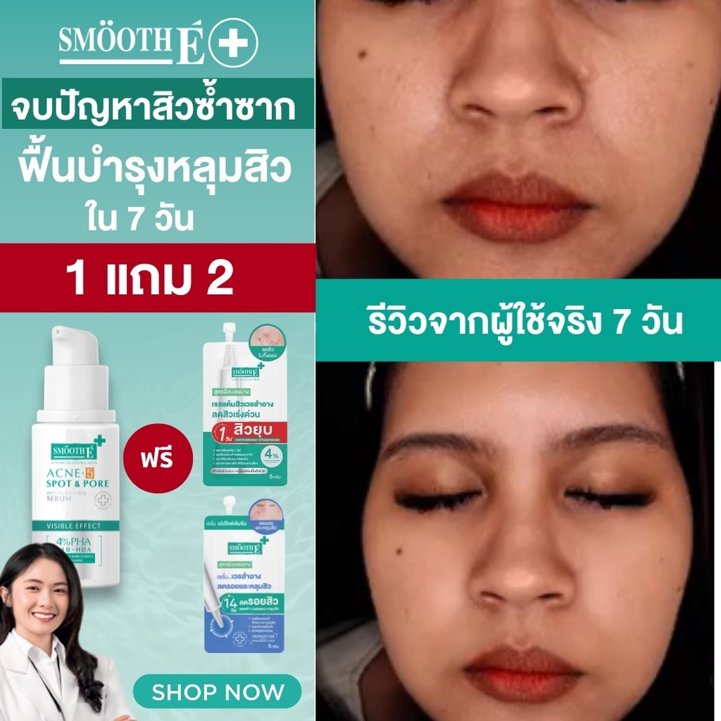 [ซื้อ 1 ฟรี 2] Smooth E Acne Pro Oil Control Serum free Acne & SCA Serum Sachet 5 g เซ็ทสยบสิว ...