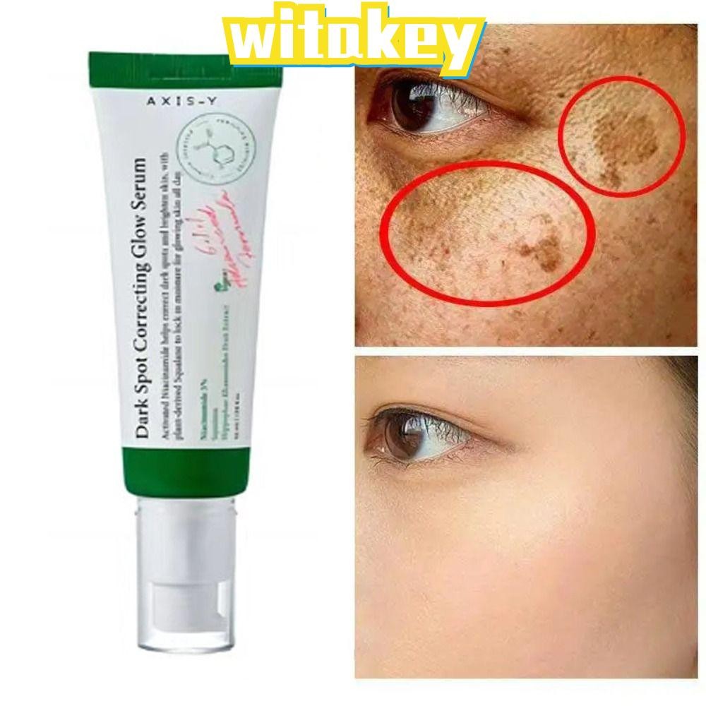 WITAKEY Moisturizing , Fade Color Spots Non-Greasy Refreshed , ที่มีประสิทธิภาพ Fade Freckles ...
