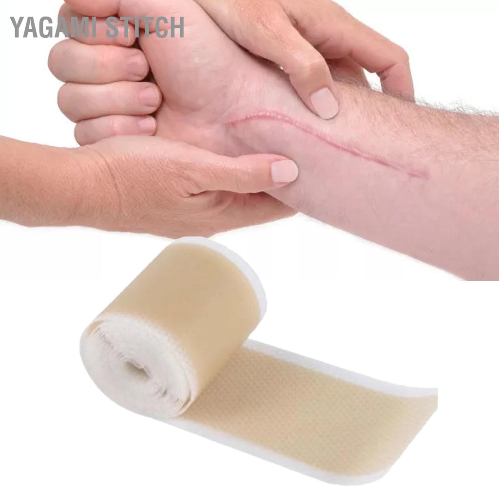 Yagami Stitch Stretch Mark Patch ซิลิโคนนุ่มใสปกปิดใช้ซ้ำได้กาวรอย ...