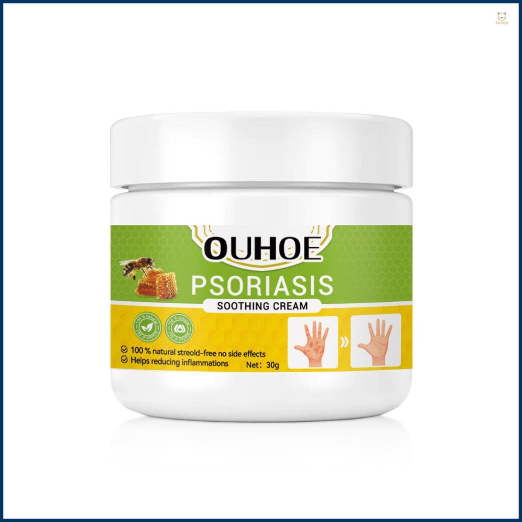 OUHOE Psoriasis Relief Cream 30g - Effective Treatment for Psoriasis ...