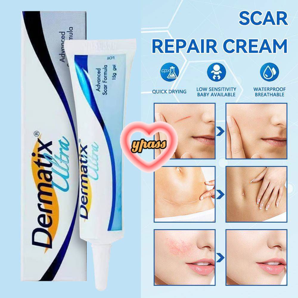CYREAL 15g Dermatix Scar Gel Acne Scars Treatment ครีมกำจัดรอยแผลเป็น ...