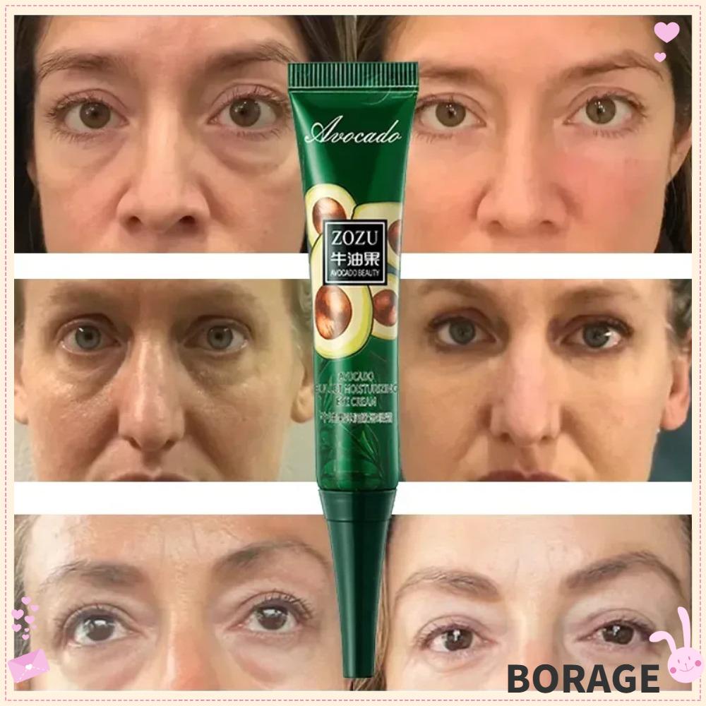 Borag อายครีม ลดรอยคล้ําใต้ตา กระชับผิว ลดริ้วรอย ลดรอยคล้ําใต้ตา สไตล์ ...