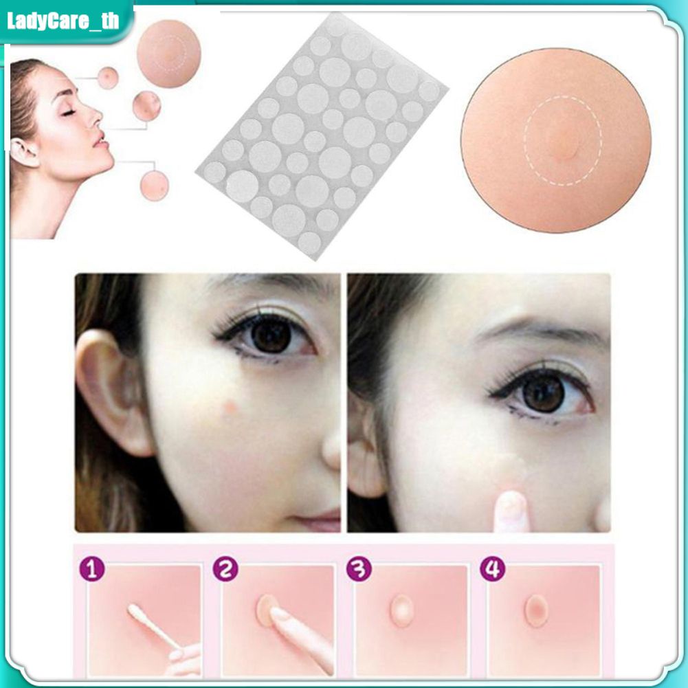 Acne Patch Skin Pimples Hidden Patch ใช้ด้วยความอุ่นใจ Remover A Pit บน ...