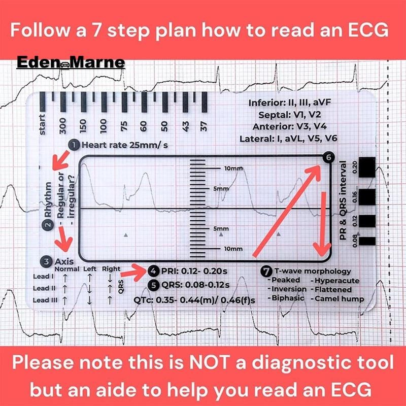 [Eden_Marner]ไม้บรรทัด Ecg 7 Step, ไม้บรรทัด ECG 7 Step สําหรับ ECG/EKG Interpretation, การ ...