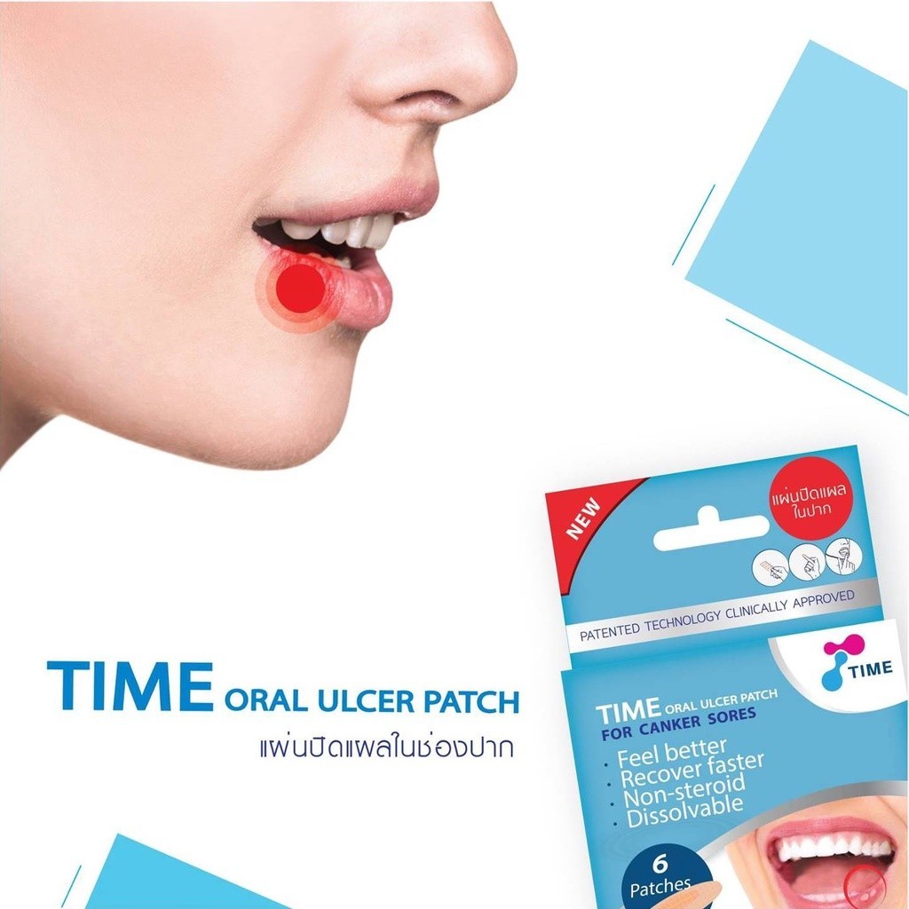 แผ่นแปะร้อนในแบบละลาย TIME ORAL ULCER PATCH ร้อนใน (แบบบรรจุ 2 ชิ้น และ รุ่นกล่อง บรรจุ 6 ชิ้น ...