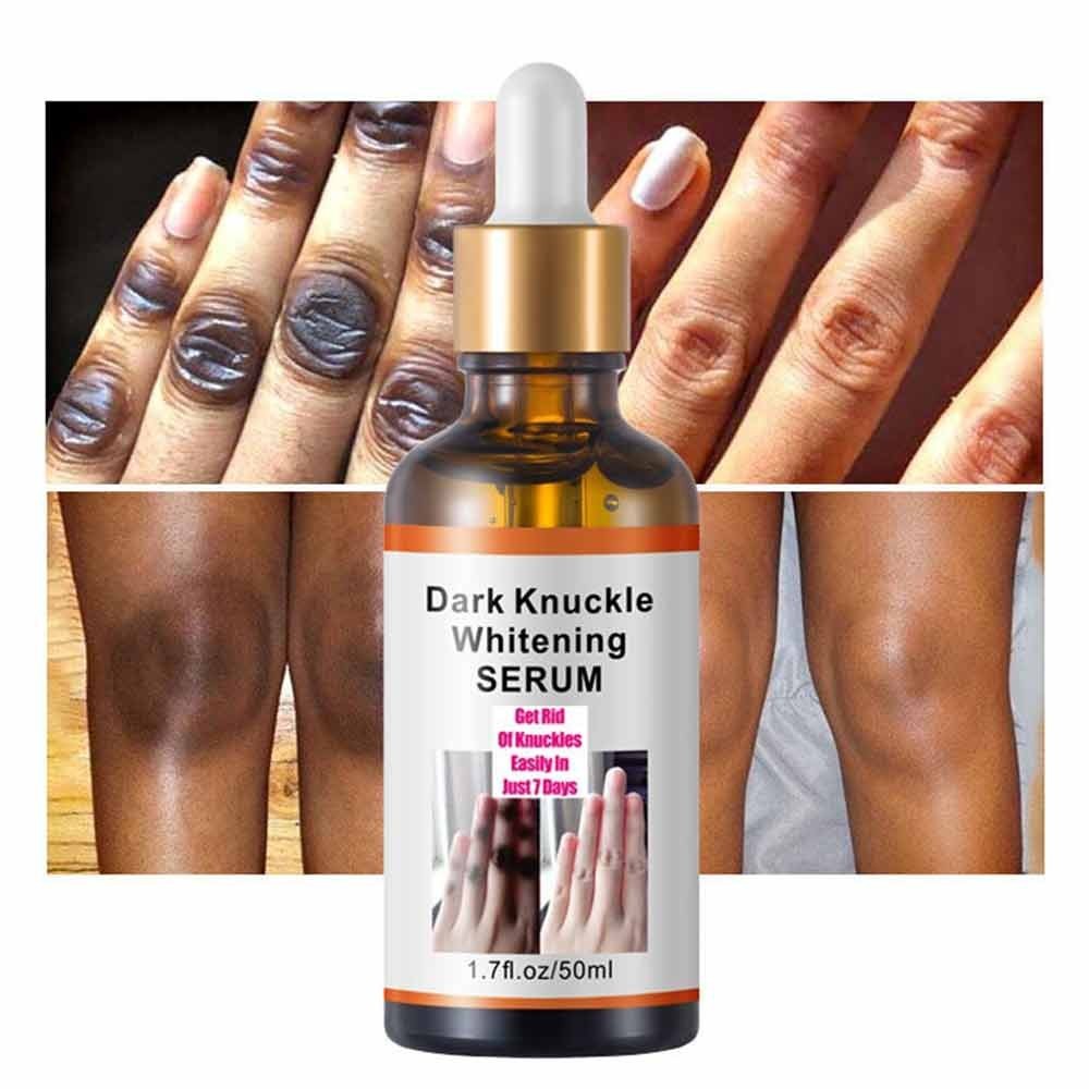 7 Days Dark Hand Knuckles Elbow And Feet Instant Remover Whitening ...