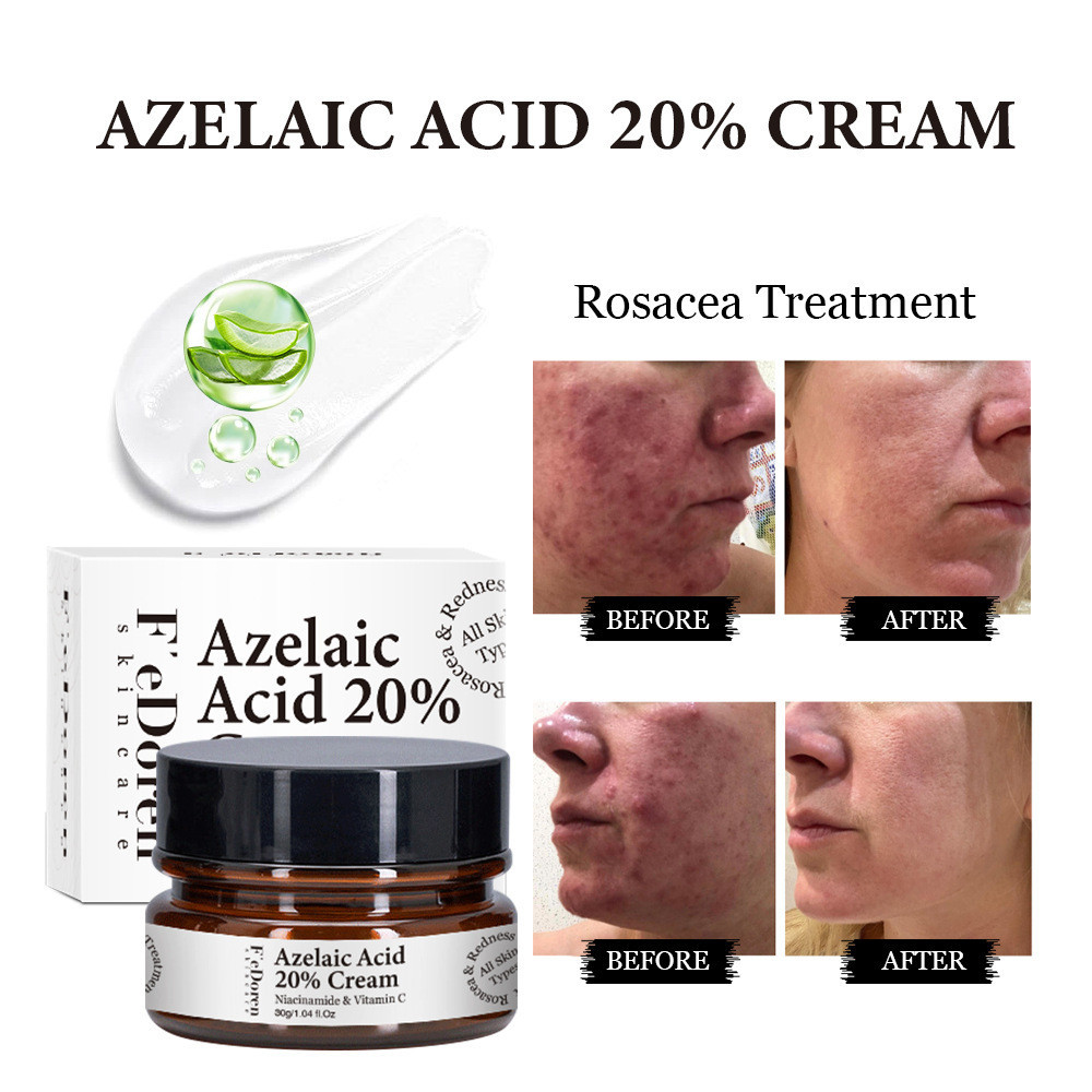ครีมกรด Azelaic 20 % Azelaic Acid Serum Cream,Face Serum Skin Care ...