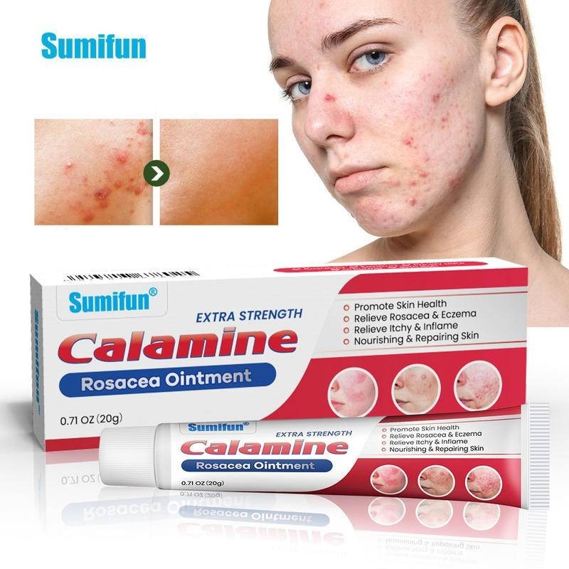 Extra Strength Calamine Rosacea Ointment Acne Repair Face Soothing ...