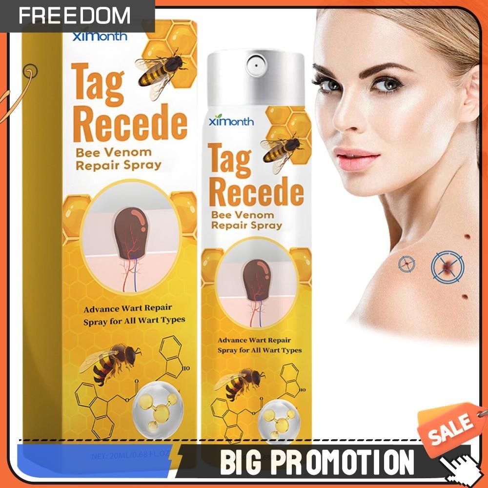 Bee Venom Treatment Spray 20ml Wart Skin Tags Removal Treatment Spray ...