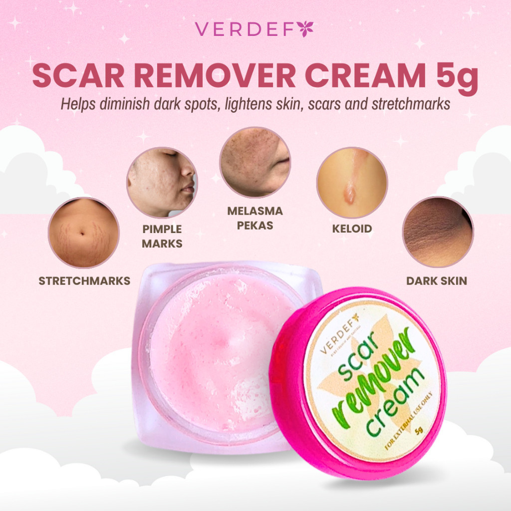 Keloid & Stretch Mark Remover CREAM ครีมลบรอยแผลเป็น MIRACLE CREAM ...